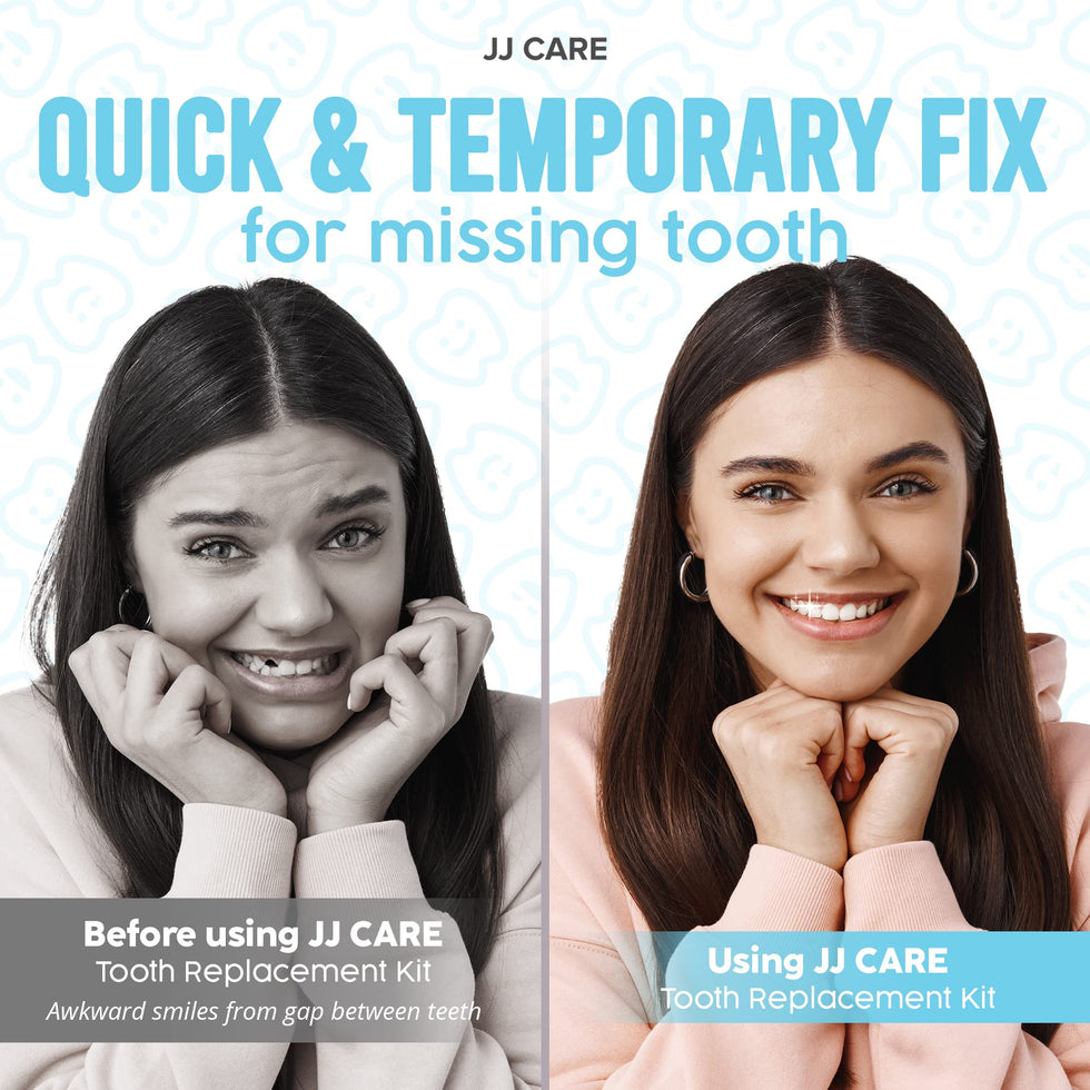 JJ CARE Temporary Tooth Replacement Kit with Dental Tools, Moldable Th ...